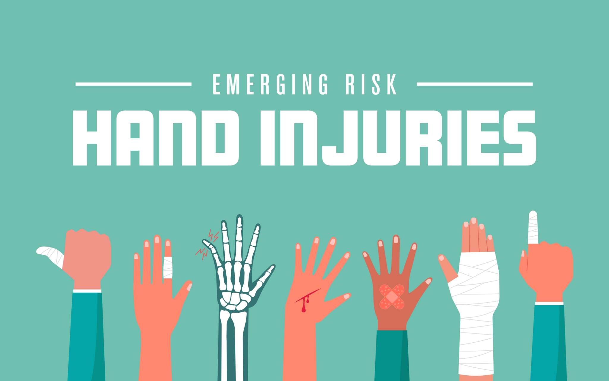 Emerging Risk - Hand Injuries